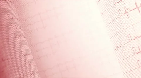 Hospital, ECG medical background. LOOP. | Stock Video | Pond5