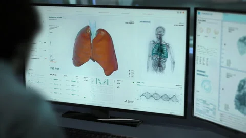 Hospital Medical Laboratory Scan Softwar... | Stock Video | Pond5