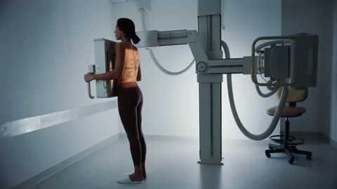Hospital Procedure Woman Gets X Ray Scan... | Stock Video | Pond5