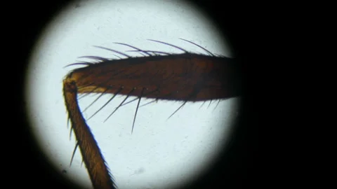 House Fly leg, magnified through microsc... | Stock Video | Pond5