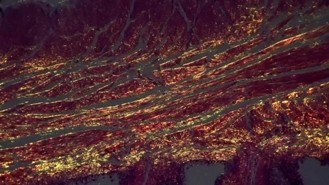 Human bladder in section void filmed und... | Stock Video | Pond5