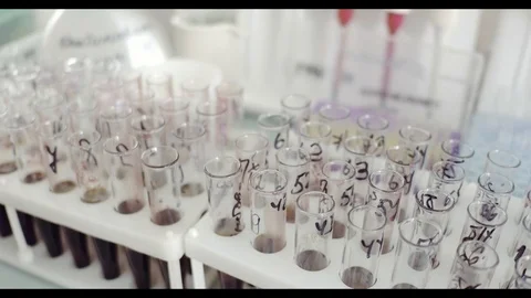 Human blood and dna laboratory, genetic ... | Stock Video | Pond5
