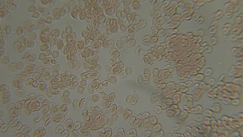 Human Blood, Diseases, Interstitial Flui... | Stock Video | Pond5