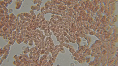 Human Blood, Diseases, Interstitial Flui... | Stock Video | Pond5