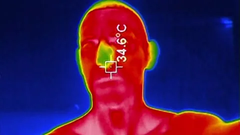 Thermography Human Body Stock Footage ~ Royalty Free Stock Videos | Pond5