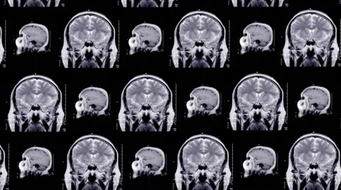 Human brain. Animated background | Stock Video | Pond5