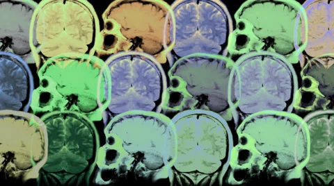 Human brain. Animated background | Stock Video | Pond5