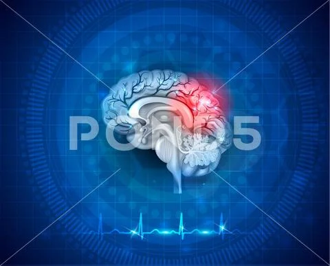 Human brain damage and treatment ~ Clip Art #80672343