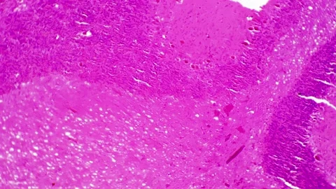 Human cerebellum in section under micros... | Stock Video | Pond5