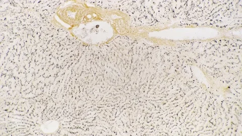 Human cholangiole in section filmed unde... | Stock Video | Pond5