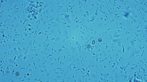 Human dental plaque under a microscope. ... | Stock Video | Pond5