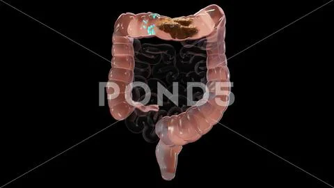 Human digestive system anatomy, concept of the intestine, laxative ...