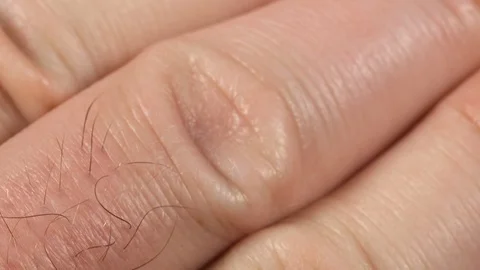 Human fingers close up. Human skin backg... | Stock Video | Pond5