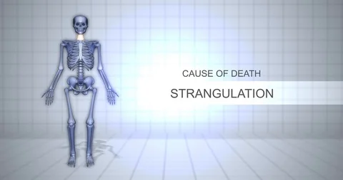 Human Forensic Autopsy Animation Concept... | Stock Video | Pond5
