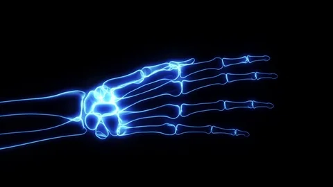 Human Hand Under X-Ray in Loop | Stock Video | Pond5