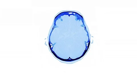Human Head CT Scan, blue on white backgr... | Stock Video | Pond5