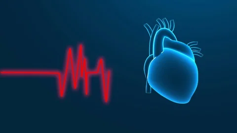 Human Heart attack with cardiogram and X... | Stock Video | Pond5
