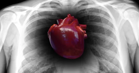Human Heart Beat Anatomy. X-Ray Skeleton... | Stock Video | Pond5