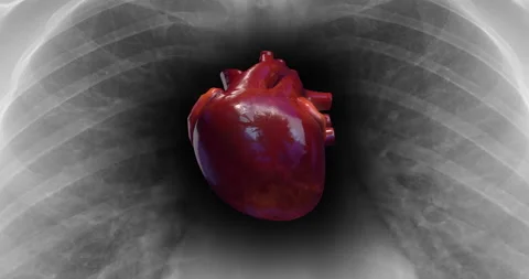 Human Heart Beat Inside Of X-Ray Skeleto... | Stock Video | Pond5