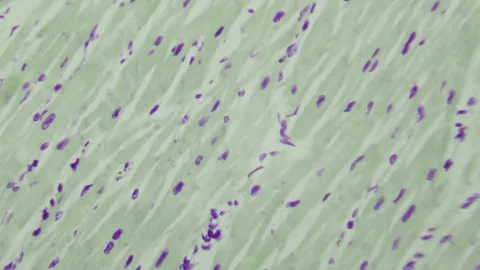 Smooth Muscle Tissue 400x