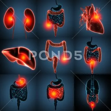 Human internal organs disease set 3d rendering Illustration #62999216