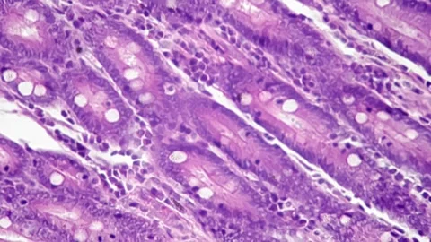 Human jejunum in section filmed under sc... | Stock Video | Pond5