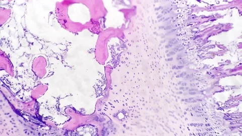 Human joint filmed under microscope 100x... | Stock Video | Pond5