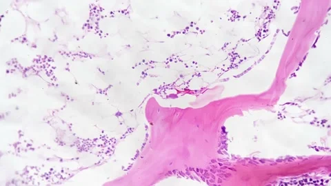 Human joint filmed under microscope with... | Stock Video | Pond5