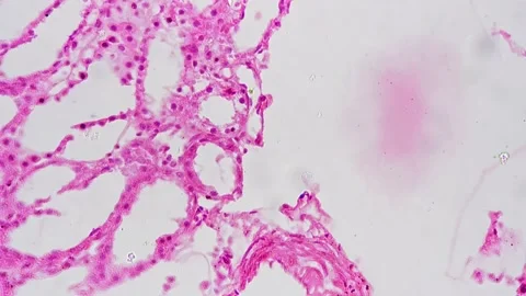 Human kidney tissue magnified 400x under... | Stock Video | Pond5