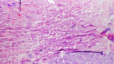 Human lip in section shown under light m... | Stock Video | Pond5