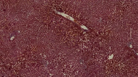 Human liver cells under a microscope zoo... | Stock Video | Pond5