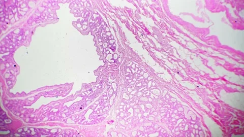 Human mammary gland in secretion stage f... | Stock Video | Pond5