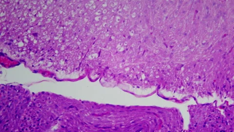 Human nerve bundle under microscope. Cro... | Stock Video | Pond5