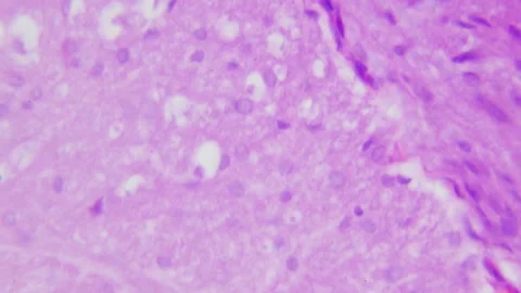 Human nerve bundle under microscope. Cro... | Stock Video | Pond5