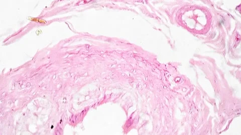 Human pancreas tissue in section filmed ... | Stock Video | Pond5