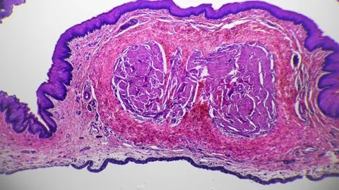 Human penis in cross section filmed unde... | Stock Video | Pond5