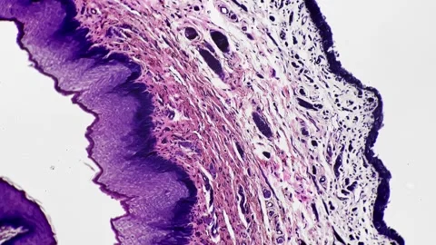 Human penis in cross section filmed unde... | Stock Video | Pond5