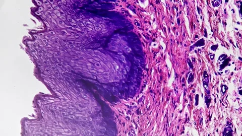 Human penis in cross section filmed unde... | Stock Video | Pond5