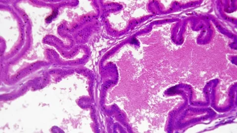 Human prostate gland in section filmed u... | Stock Video | Pond5