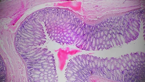 Human Tissue Stock Footage ~ Royalty Free Stock Videos | Pond5