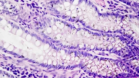 Human rectum tissue magnified under micr... | Stock Video | Pond5