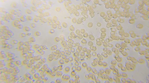 Human red blood cells, through microscop... | Stock Video | Pond5