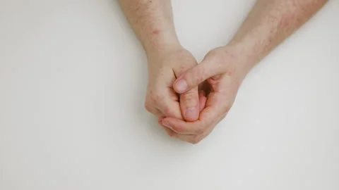 Human scratches hands, fingers with itch... | Stock Video | Pond5