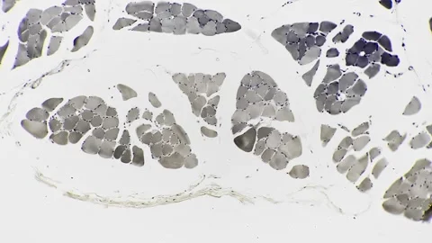 Human skeletal muscle under microscope w... | Stock Video | Pond5
