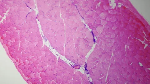 Human skeletal muscle under a microscope... | Stock Video | Pond5