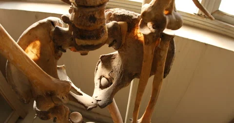 Human Skeleton From Anatomy Lab In Hospi... | Stock Video | Pond5