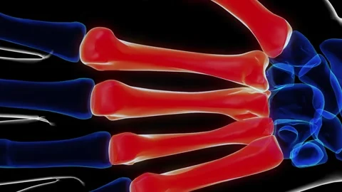 Human skeleton hand matacarapls bone ana... | Stock Video | Pond5