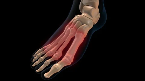 human skeleton metatarsal bones pain ana... | Stock Video | Pond5