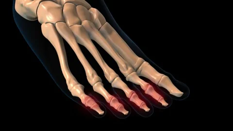 human skeleton middle phalanges of the t... | Stock Video | Pond5