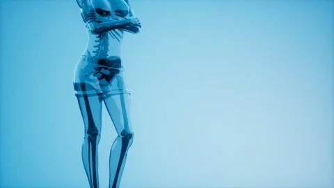 Human Skeleton Radiography Medical Scan | Stock Video | Pond5